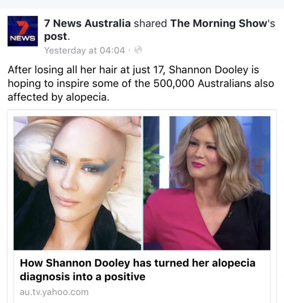 Retrosweat’s Shannon Dooley reveals her battle with Alopecia on The ...